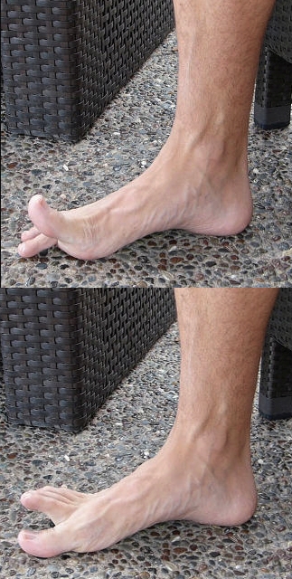 Sports Performance Bulletin - Techniques - Runners: time to add some ...