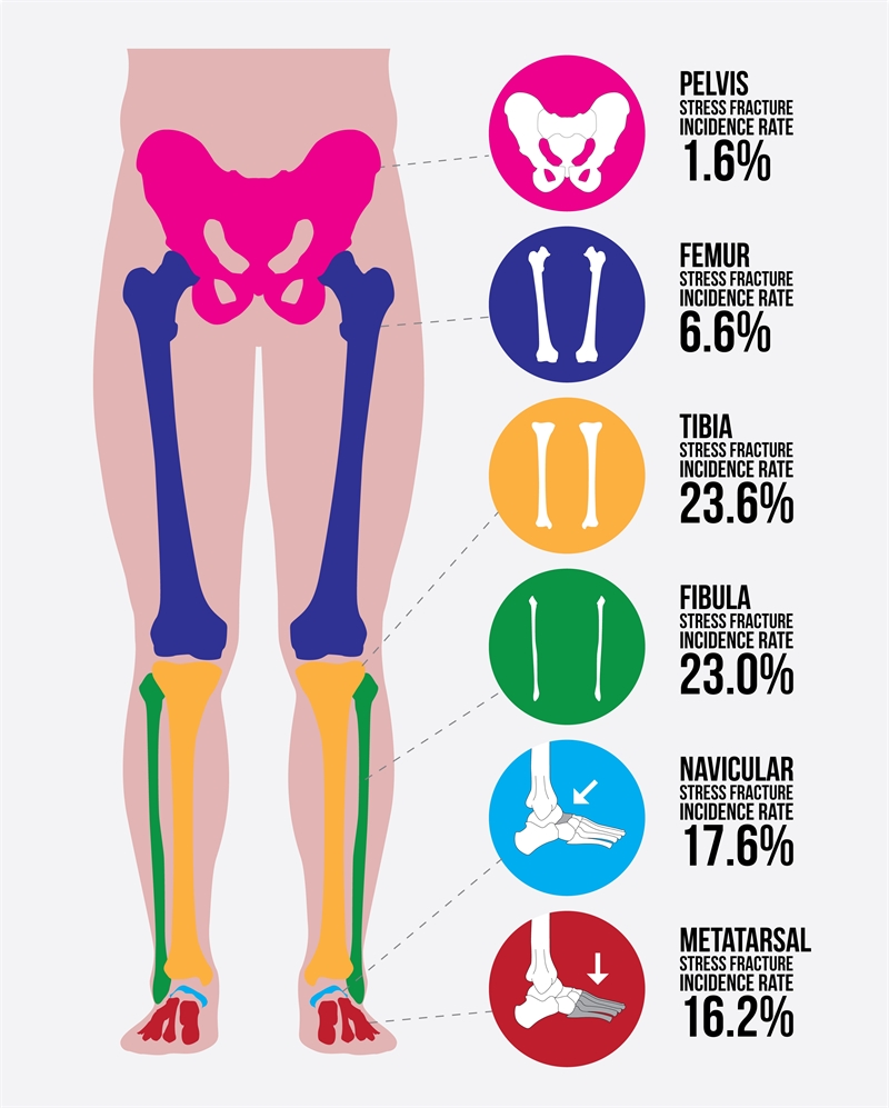Sports Performance Bulletin - Overuse injuries - Breaking point: when ...